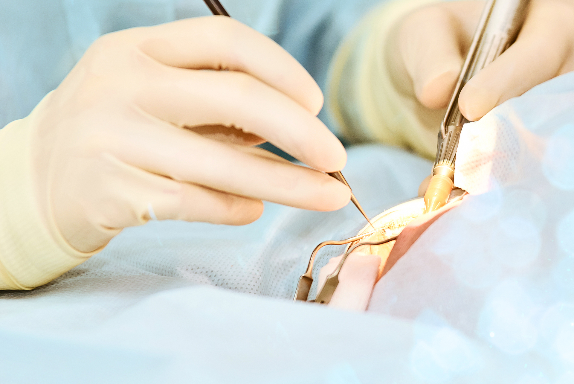 Eye Surgery - Columbia Basin Eye Clinic